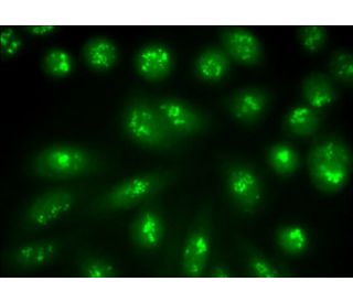 Anti-UBF Antibody (F-9) | SCBT - Santa Cruz Biotechnology