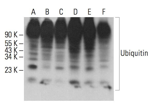 Anti-Ubiquitin Antibody (A-5) | SCBT - Santa Cruz Biotechnology