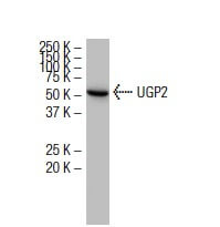 Anti-UGP2 Antibody (34-B) | SCBT - Santa Cruz Biotechnology