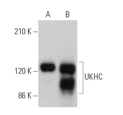 UKHC Antibody (F-5) | SCBT - Santa Cruz Biotechnology