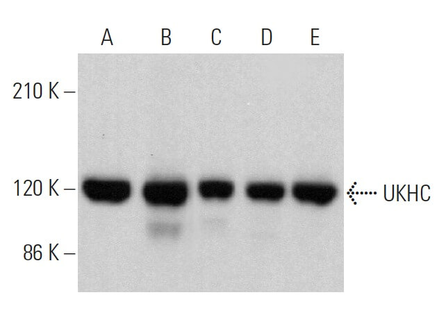 UKHC Antibody (F-5) | SCBT - Santa Cruz Biotechnology