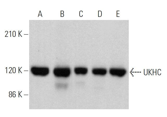 UKHC Antibody (H-50) | SCBT - Santa Cruz Biotechnology
