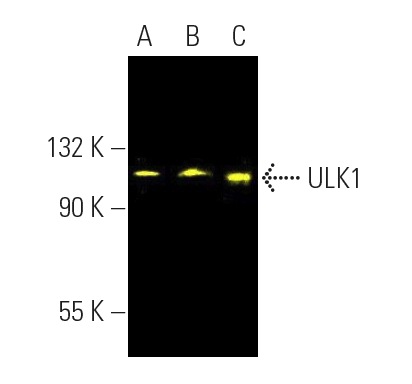 ULK1 Antibody (F-4) | SCBT - Santa Cruz Biotechnology