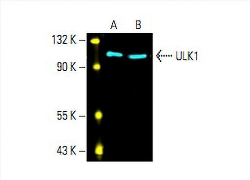 ULK1 Antibody (F-4) | SCBT - Santa Cruz Biotechnology
