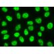 Aqueous Mounting Medium with DAPI – UltraCruz® | SCBT - Santa Cruz ...