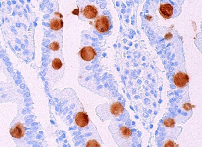 UltraCruz® Blocking Reagent | SCBT - Santa Cruz Biotechnology