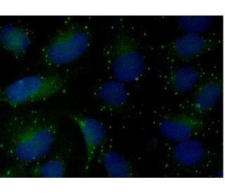 UltraCruz® Hard-set Mounting Medium with DAPI | SCBT - Santa Cruz ...