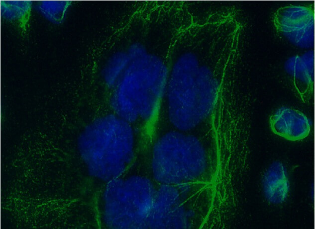 UltraCruz® Hard-set Mounting Medium with DAPI | SCBT - Santa Cruz ...
