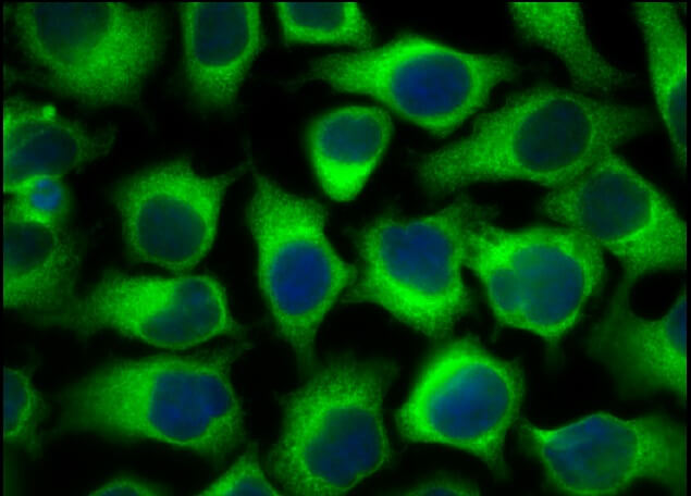 UltraCruz® Hard-set Mounting Medium with DAPI | SCBT - Santa Cruz ...