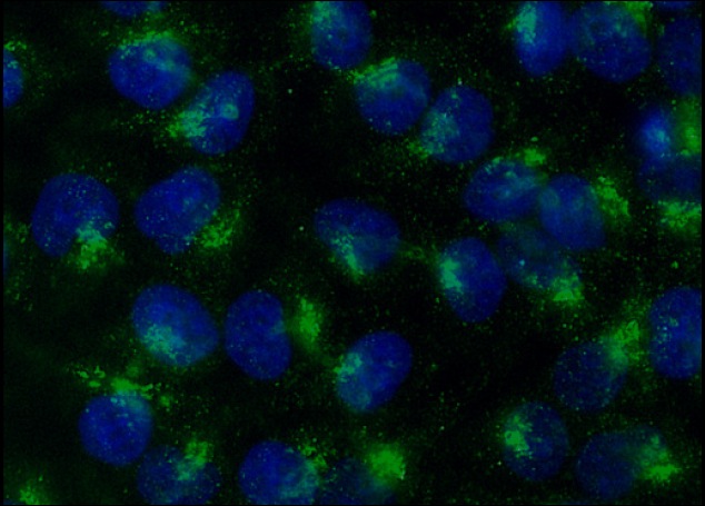 UltraCruz® Hard-set Mounting Medium with DAPI | SCBT - Santa Cruz ...