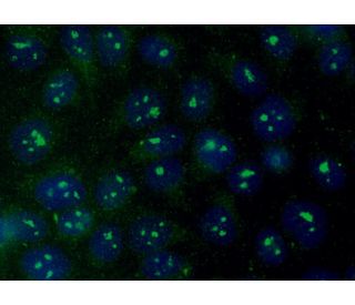 UltraCruz® Hard-set Mounting Medium with DAPI | SCBT - Santa Cruz ...