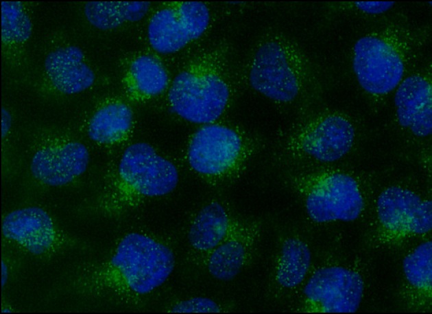 UltraCruz® Hard-set Mounting Medium with DAPI | SCBT - Santa Cruz ...