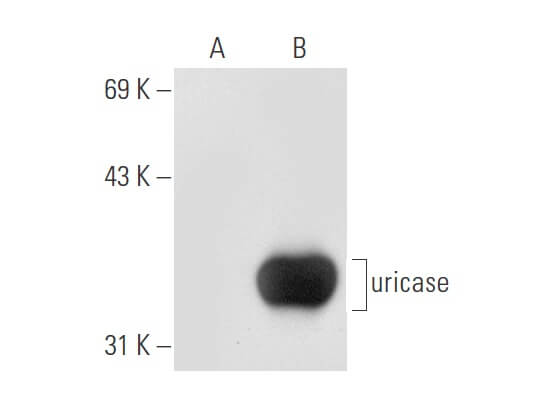 uricase Antibody (F-7) | SCBT - Santa Cruz Biotechnology