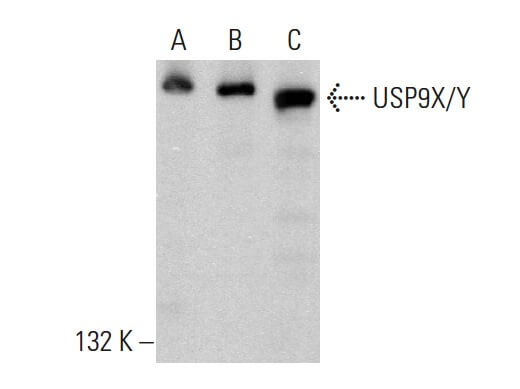 Anti-USP9X/Y Antibody (E-12) | SCBT - Santa Cruz Biotechnology