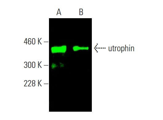 Anti-utrophin Antibody (8A4) | SCBT - Santa Cruz Biotechnology