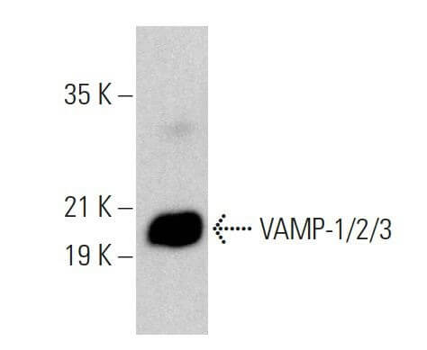 VAMP-1/2/3 Antibody (F-11) | SCBT - Santa Cruz Biotechnology