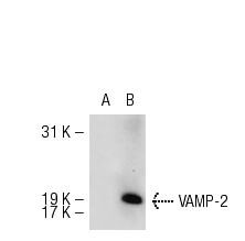 VAMP-1/2 Antibody (SP11) | SCBT - Santa Cruz Biotechnology
