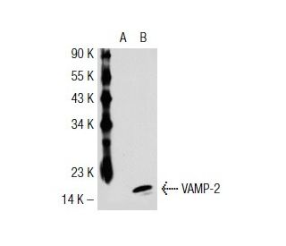 VAMP-2 Antibody (3E5) - Western Blotting - Image 32776