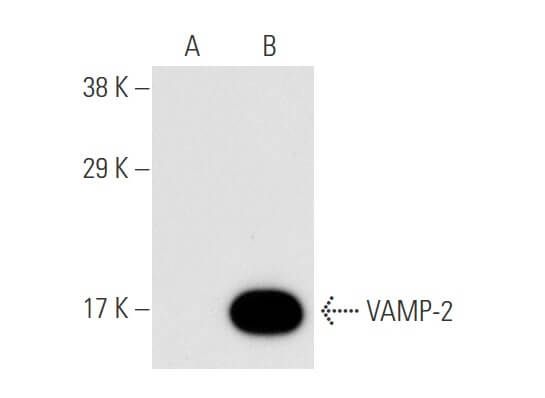 VAMP-2抗体 (3E5) | SCBT - Santa Cruz Biotechnology