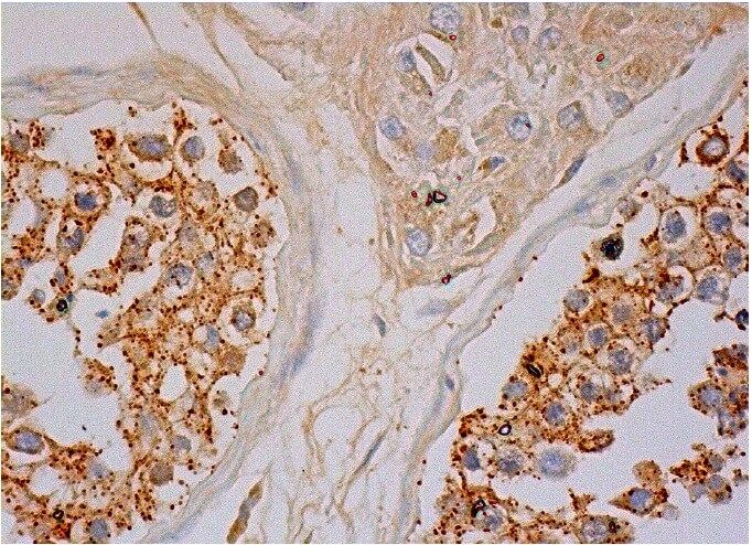 VAMP-4 Antibody (D-2) | SCBT - Santa Cruz Biotechnology