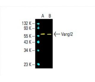 Vangl2 Antibody (C-2) | SCBT - Santa Cruz Biotechnology