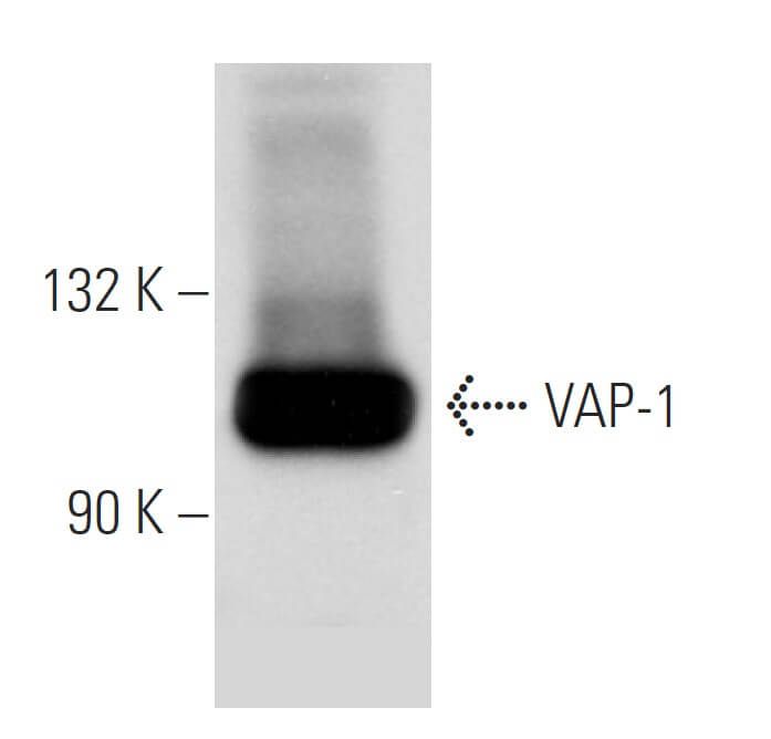 VAP-1 Antibody (TK8-14) | SCBT - Santa Cruz Biotechnology