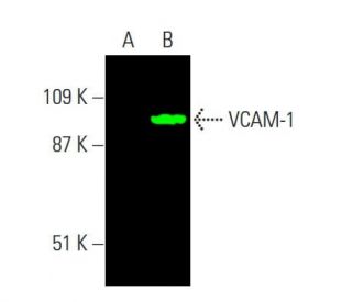 VCAM-1 Antibody (E-10) - Western Blotting - Image 384993
