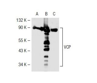 Anti-VCP Antibody (5) | SCBT - Santa Cruz Biotechnology