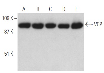 Anti-VCP Antibody (5) | SCBT - Santa Cruz Biotechnology