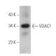 Anti-VDAC1/Porin Antibody (B-6) | SCBT - Santa Cruz Biotechnology