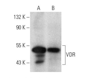 VDR Antibody (D-6) - Western Blotting - Image 1641