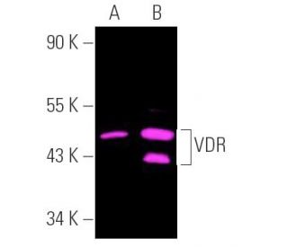 VDR Antibody (D-6) - Western Blotting - Image 390734