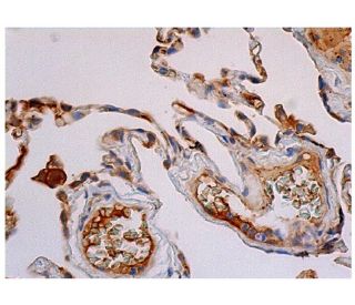 Anti-VEGF Antibody (VG-1) | SCBT - Santa Cruz Biotechnology