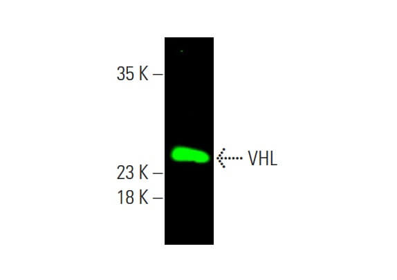 Anti-Von Hippel Lindau/VHL Antibody (G-3) | SCBT - Santa Cruz Biotechnology