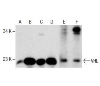 VHL Antibody (VHL40) - Western Blotting - Image 287163