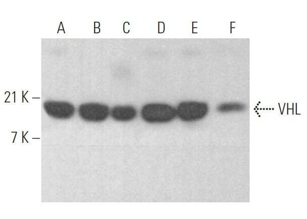 Von Hippel Lindau/VHL抗体 (VHL40) | SCBT - Santa Cruz Biotechnology