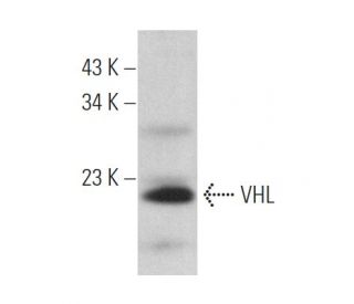 VHL Antibody (VHL40) - Western Blotting - Image 361697