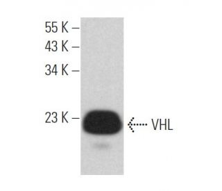 VHL Antibody (VHL40) - Western Blotting - Image 361698