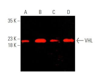 VHL Antibody (VHL40) - Western Blotting - Image 375696