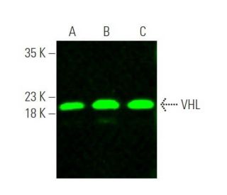 VHL Antibody (VHL40) - Western Blotting - Image 375697