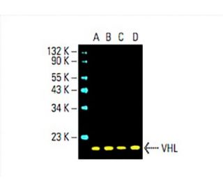 VHL Antibody (VHL40) - Western Blotting - Image 394680
