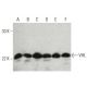 Anti-Von Hippel Lindau/VHL Antibody (VHL40) | SCBT - Santa Cruz ...