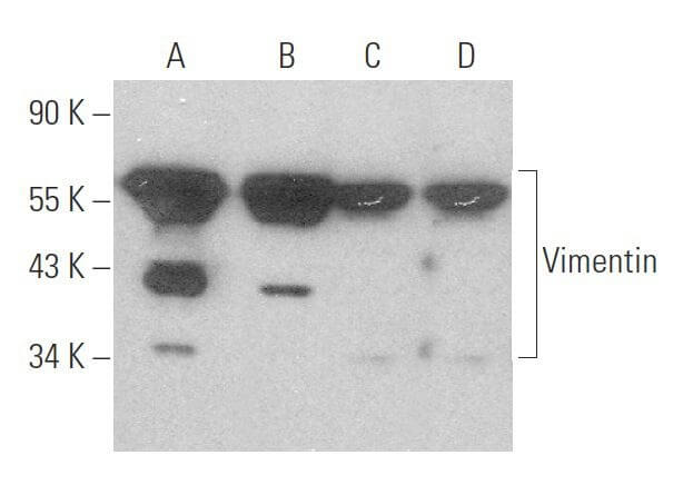 Anti-Vimentin Antibody (5G3F10) | SCBT - Santa Cruz Biotechnology