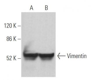 Vimentin Antibody (E-5) - Western Blotting - Image 362876