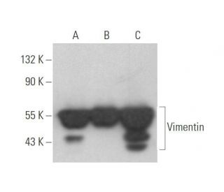 Vimentin Antibody (V9) - Western Blotting - Image 352789