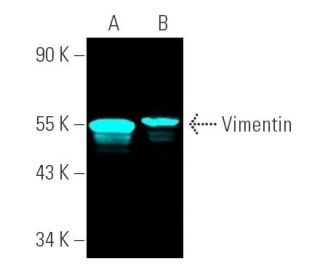 Vimentin Antibody (V9) - Western Blotting - Image 390746