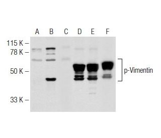 Vimentin Antibody (V9) - Western Blotting - Image 142644