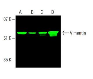 Vimentin Antibody (V9) - Western Blotting - Image 369514