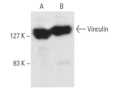 Anti-vinculin Antibody (H-10) | SCBT - Santa Cruz Biotechnology