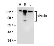 Anti-vinculin Antibody (H-10) | SCBT - Santa Cruz Biotechnology